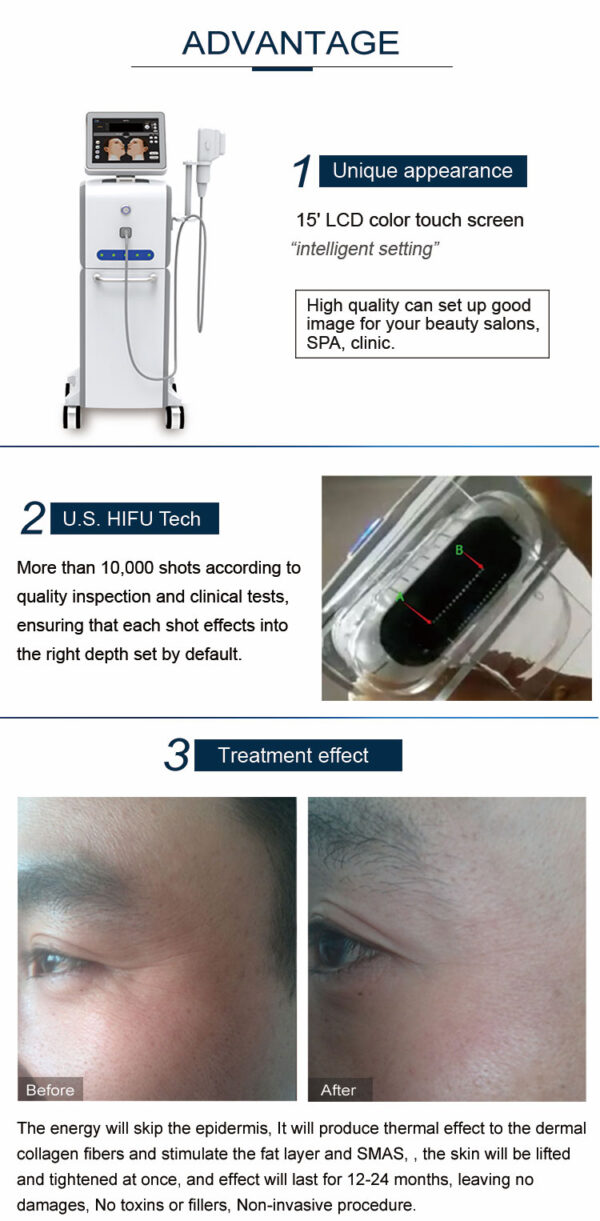 Hifu V – Tattoo removal Lasers & IPl Machines